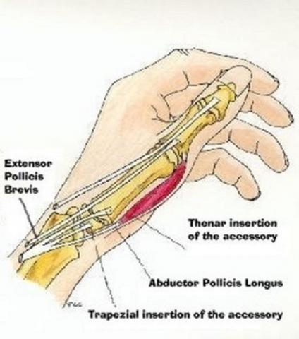No Down Time Option for Thumb Arthritis | Grand Rapids MI Orthopedists